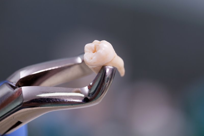 No Pain? 4 Reasons Why You May Still Need Tooth Extraction - Goodyear ...